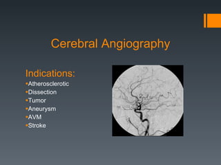 Contrast Agents in Angiography | PPT