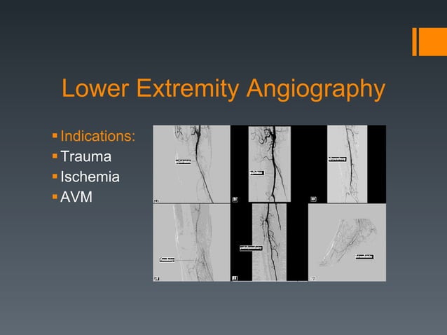 Contrast Agents in Angiography | PPT