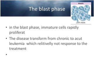 Chronic Myeloid Leukemia | PPTX