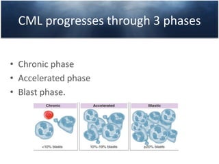 Chronic Myeloid Leukemia | PPTX