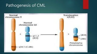Myeloproliferative disease- CML | PPT