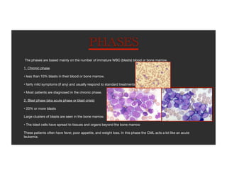 CML.PPT,CHRONIC MYELOID LEUKEMIA:HEMATOLOGY | PDF