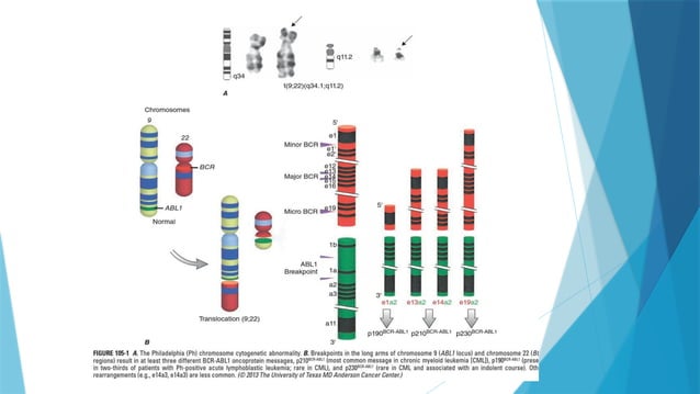 Chronic Myelogenous leukemia (CML) .pptx