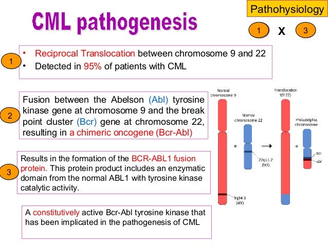 Chronic Myloid Leukemia overview (CML)