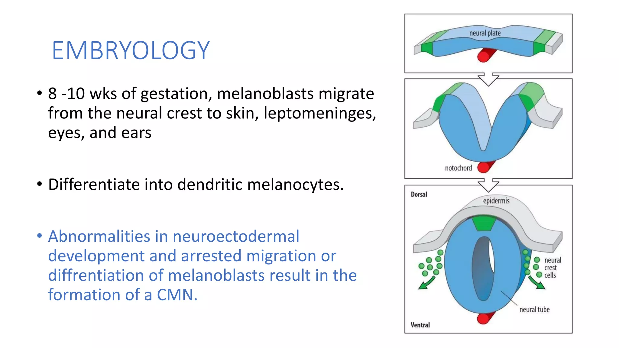 Congenital Melanocytic Nevi + Tissue Expander | PPTX
