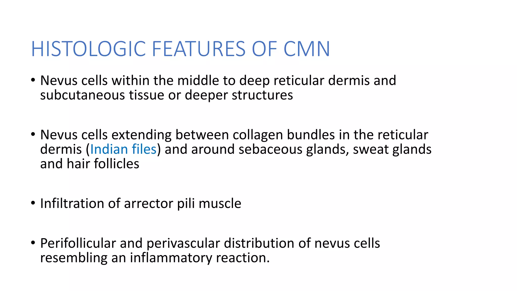 Congenital Melanocytic Nevi + Tissue Expander | PPTX