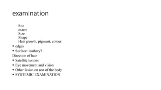 Congenital Melanocytic Nevi + Tissue Expander | PPTX