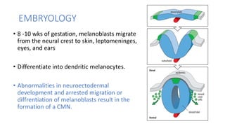 Congenital Melanocytic Nevi + Tissue Expander | PPTX