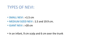 Congenital Melanocytic Nevi + Tissue Expander | PPTX