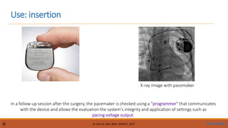 CM Pacemaker pp.pptx
