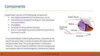 CM Pacemaker pp.pptx