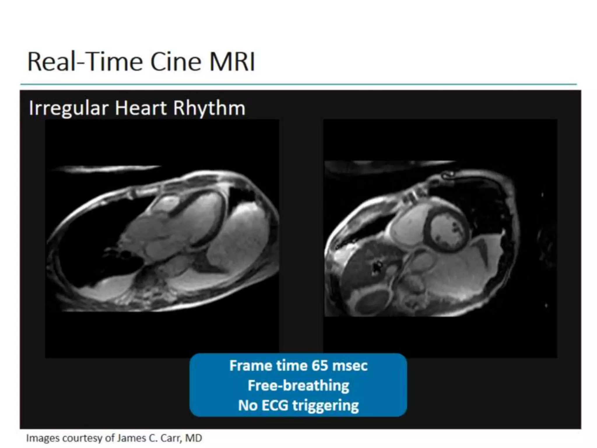 CMR (basic and application) | PPTX