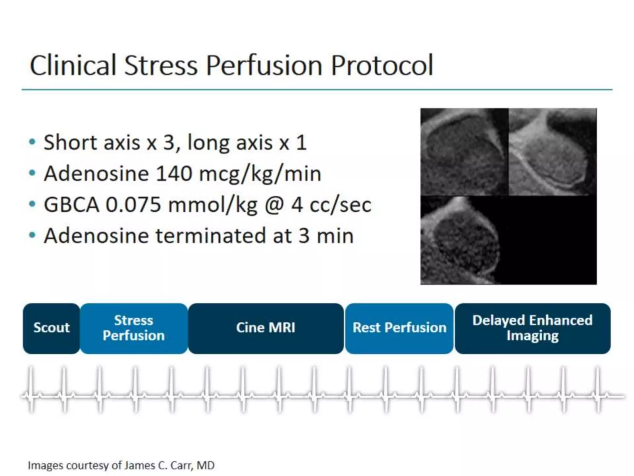 CMR (basic and application) | PPTX