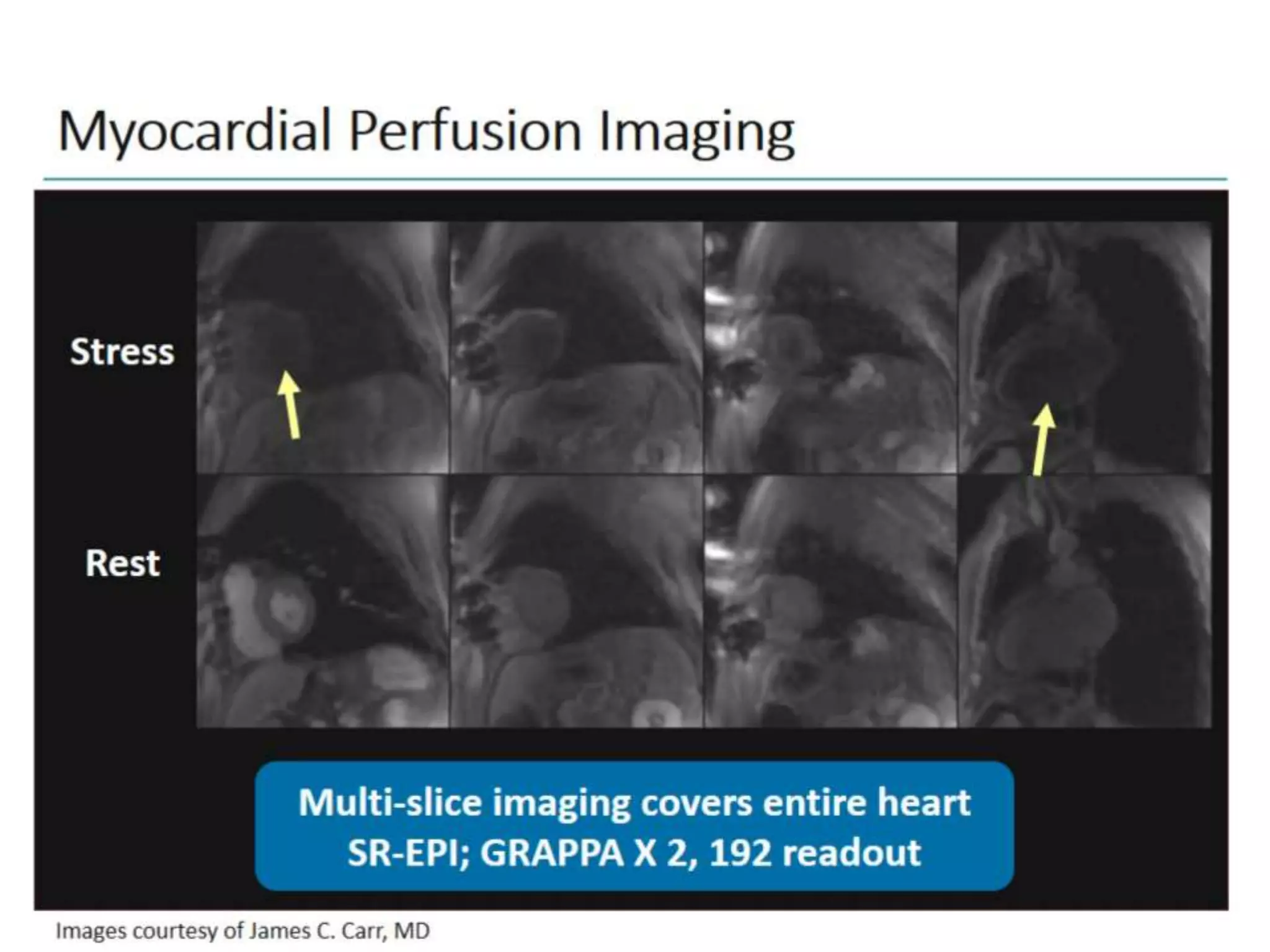 CMR (basic and application) | PPTX | Heart and Cardiovascular Diseases ...