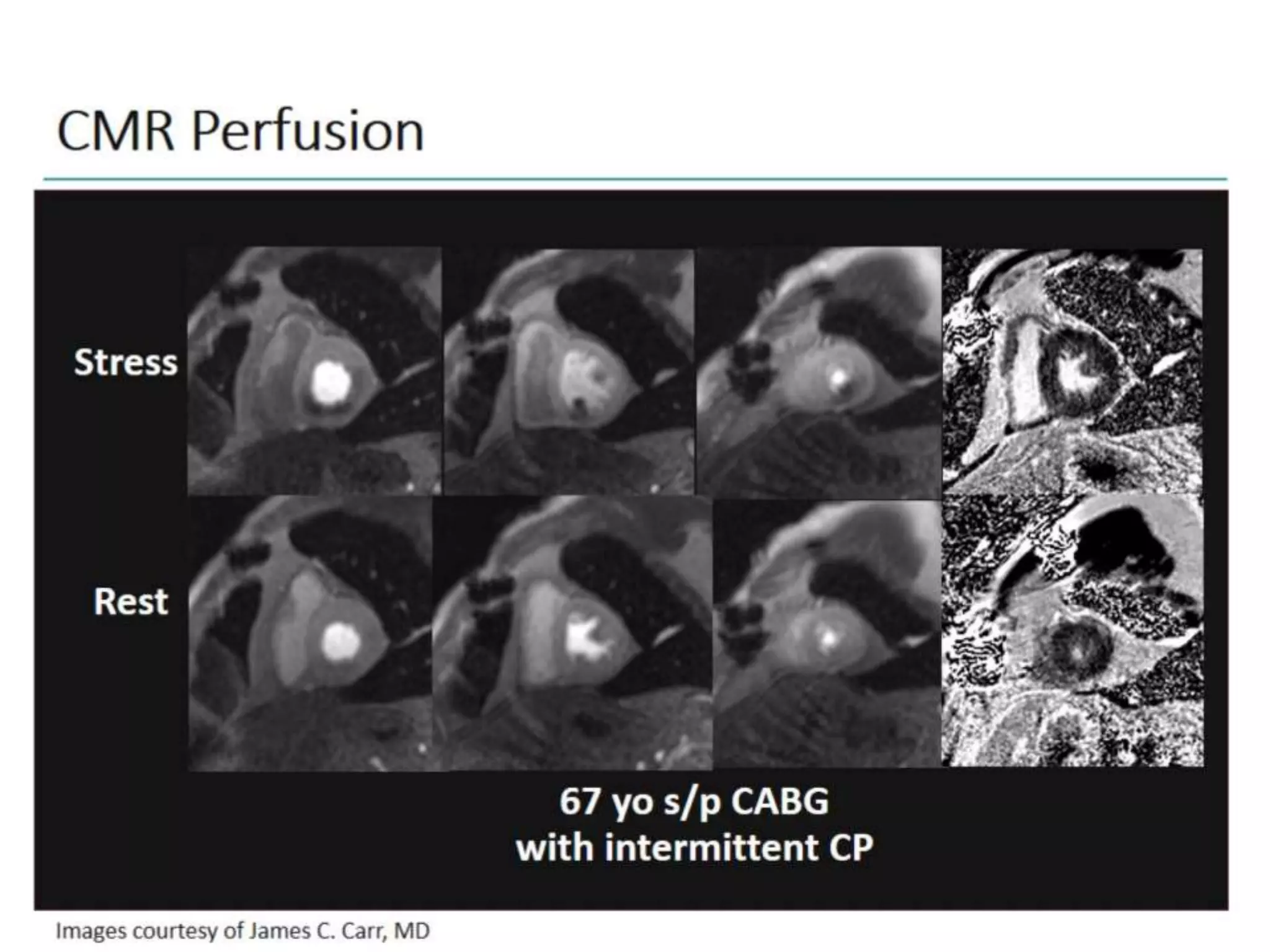 CMR (basic and application) | PPTX