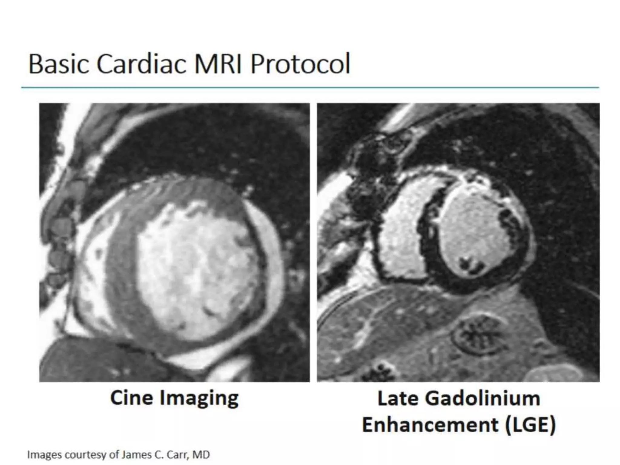 CMR (basic and application) | PPTX