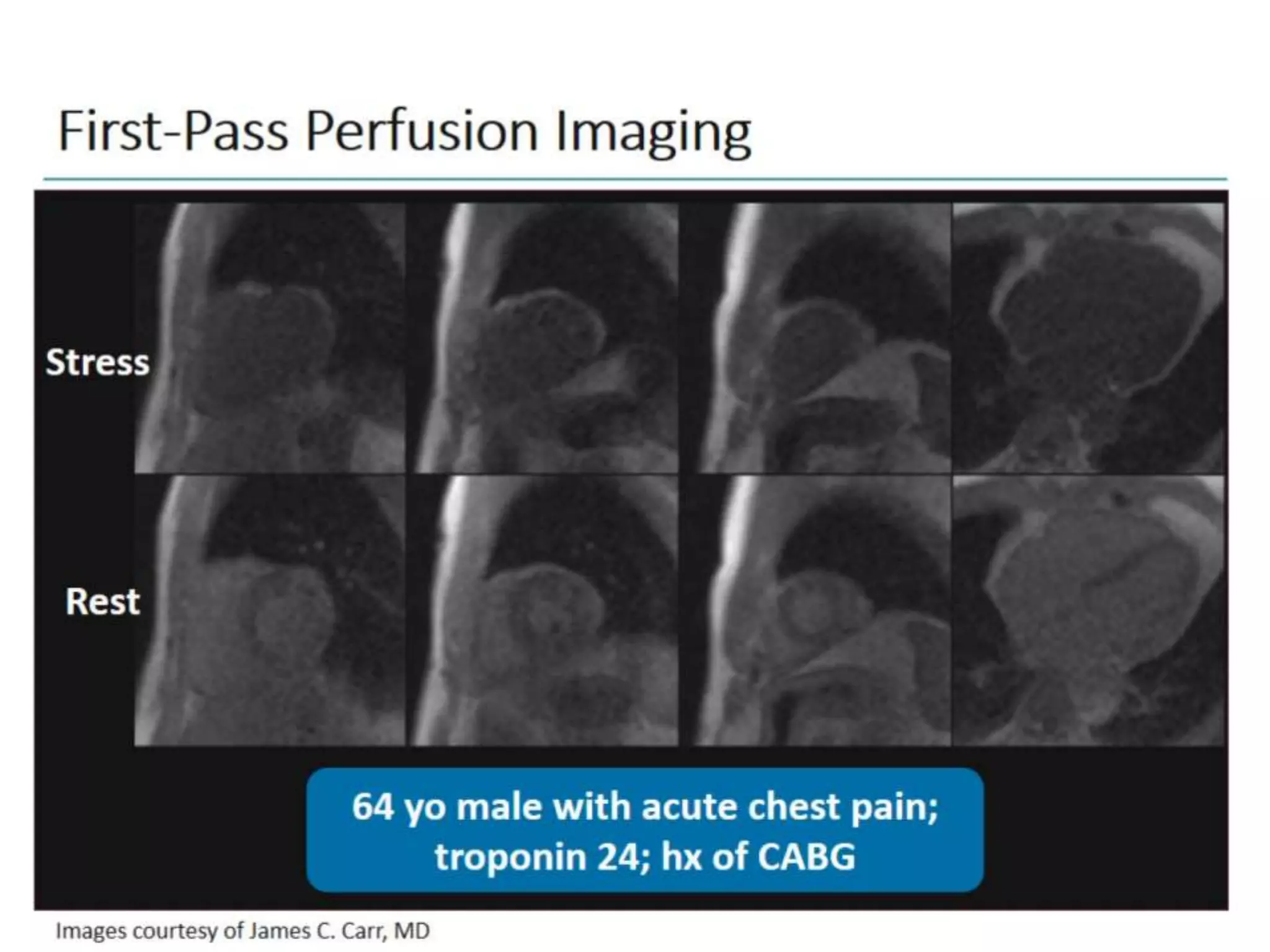 CMR (basic and application) | PPTX