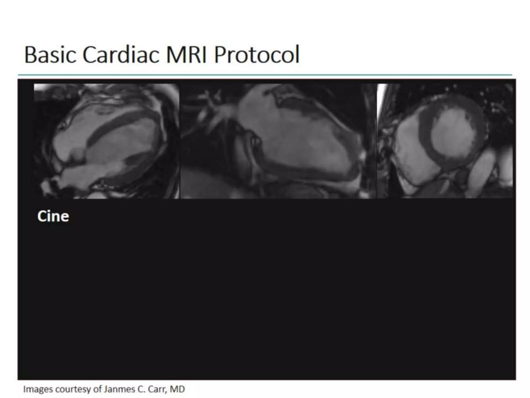 CMR (basic and application) | PPTX