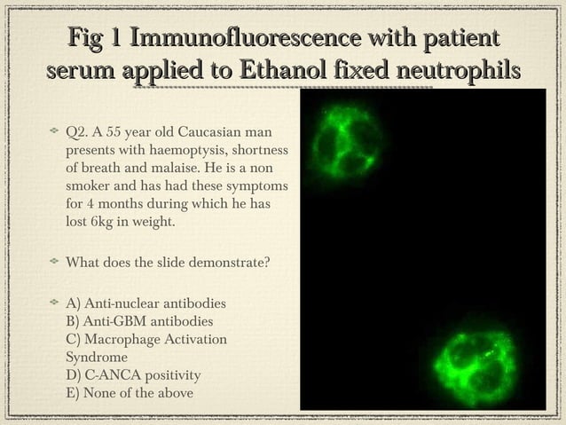 Cmt teaching lab tests ppt | PPT