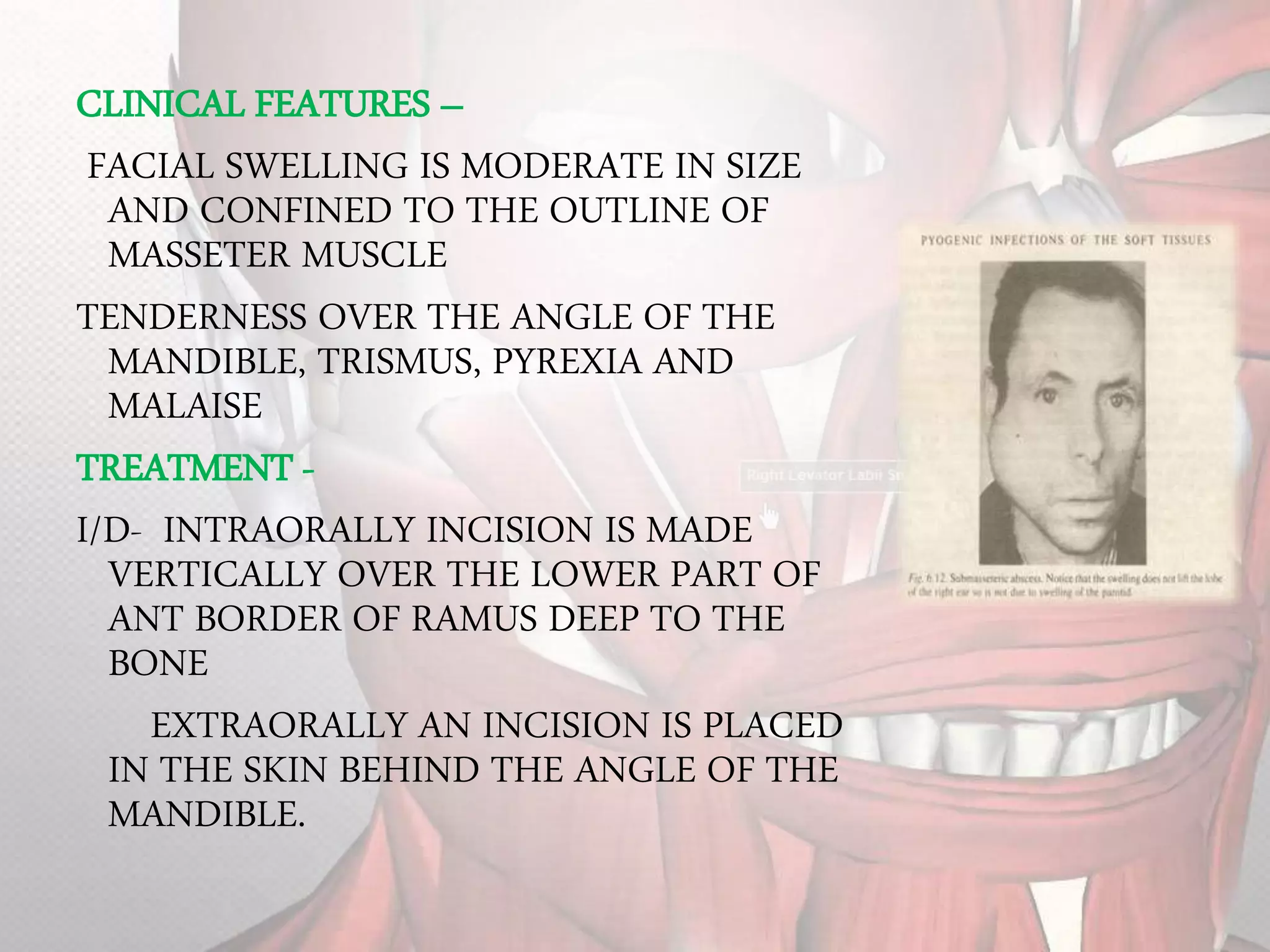 muscles of mastication | PPTX
