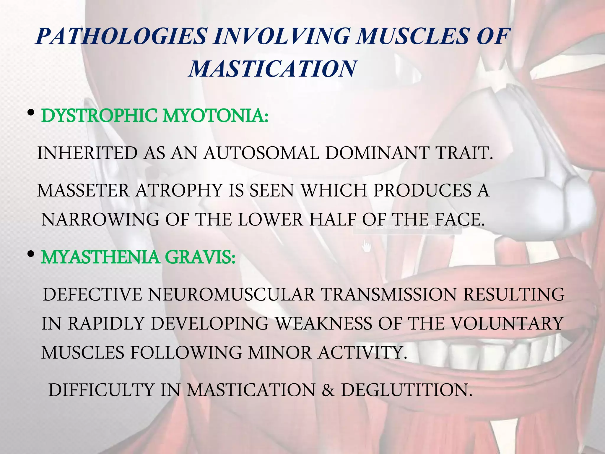 muscles of mastication | PPTX