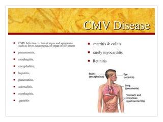 CMV in Organ Transplantation | PPT
