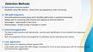 CMV.pptx