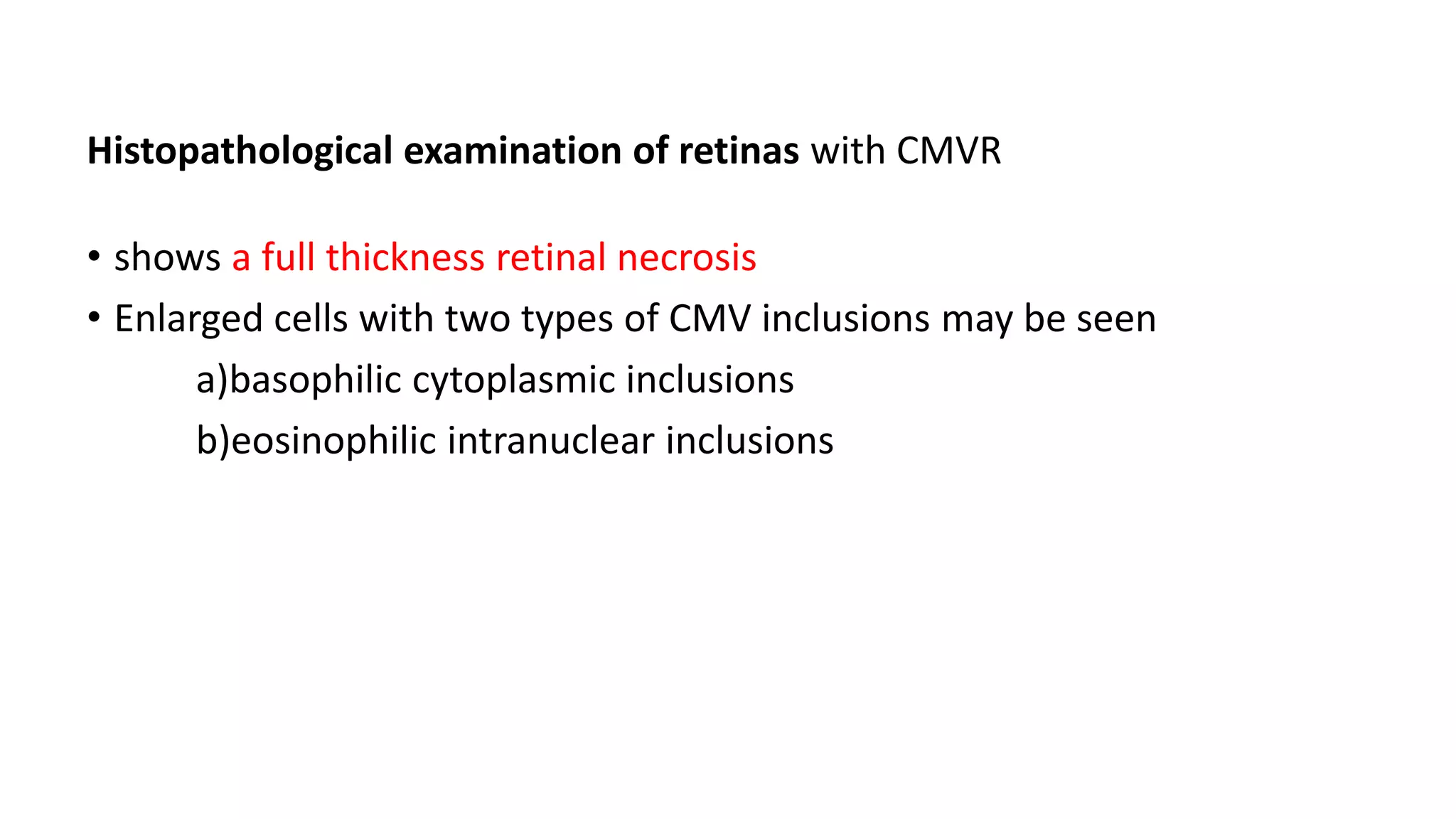 Cmv retinitis | PPTX