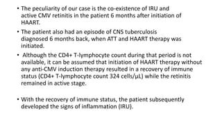 CMV RETINITS.pptx