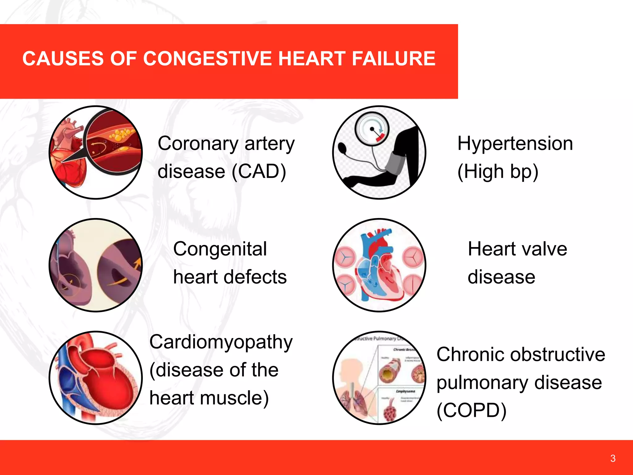 CONGESTIVE HEART FAILURE and ROLE OF ANTIOXIDANTS IN TREATMENT AND ...