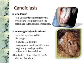 Cnadida albicans and aspergillus species | PPTX