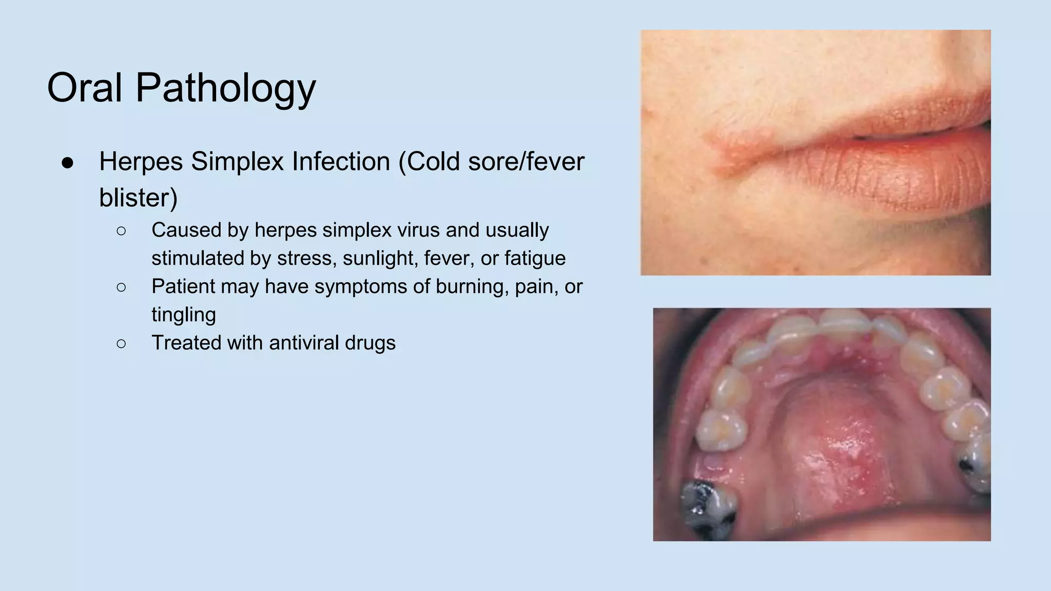 CNA Presentation | PPTX