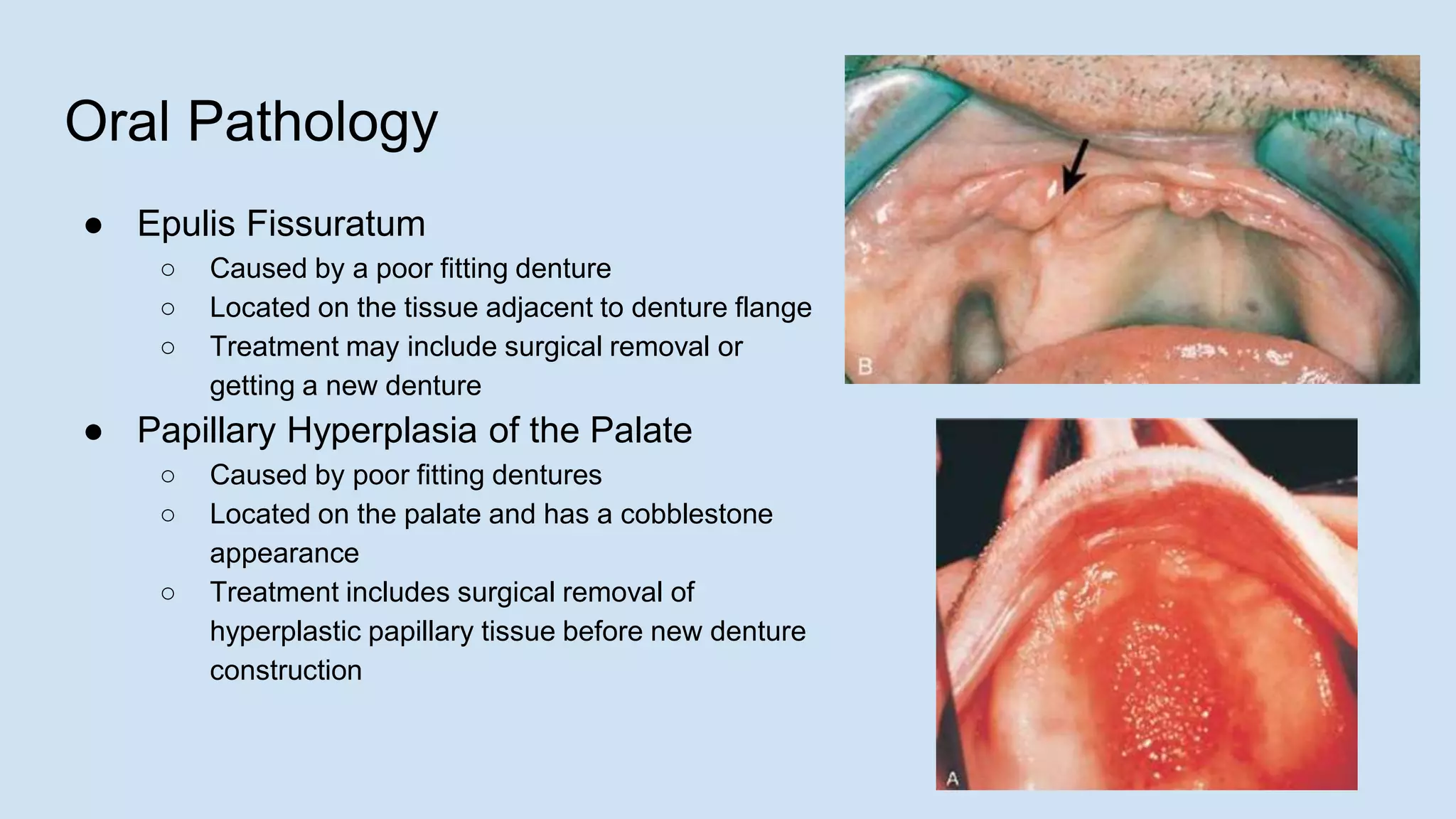 CNA Presentation | PPTX