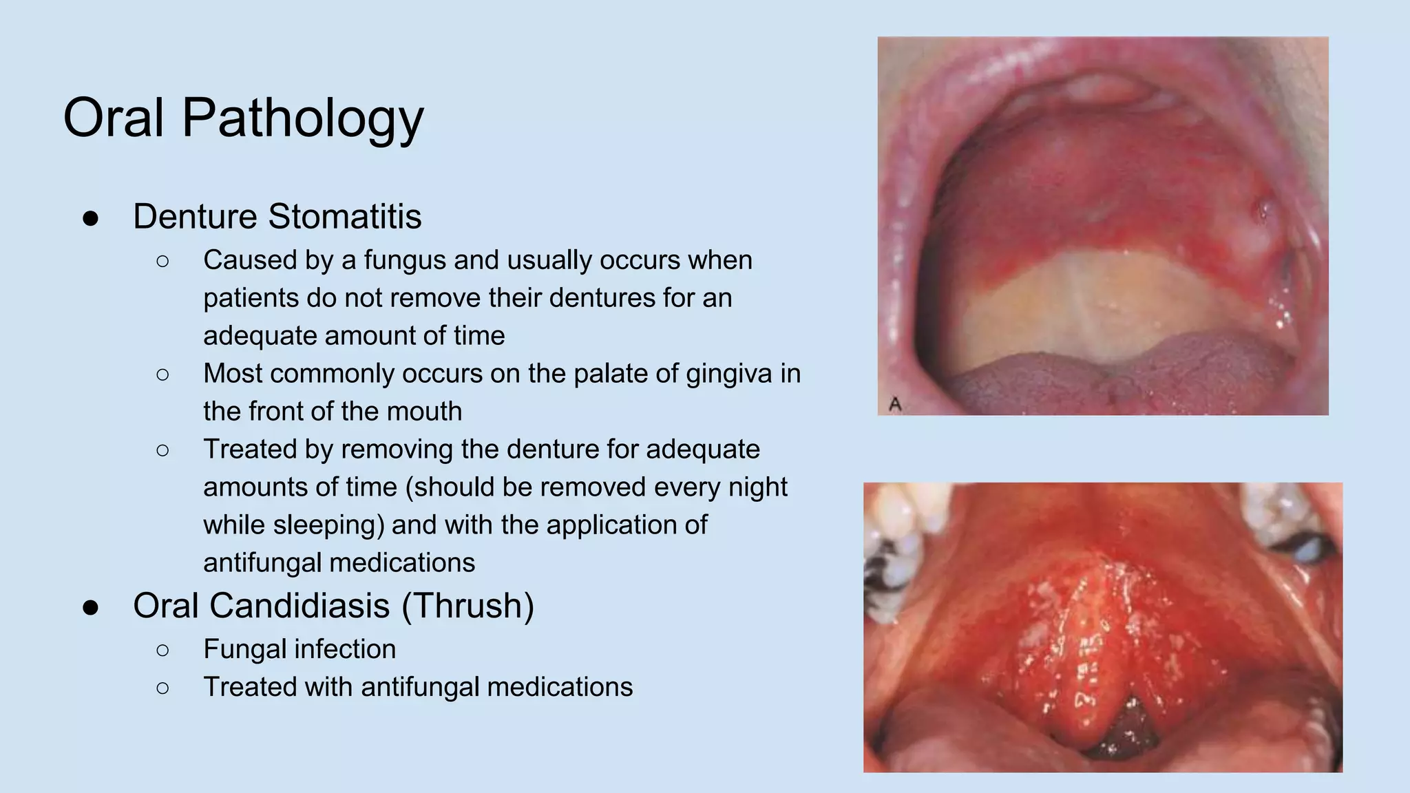 CNA Presentation | PPTX