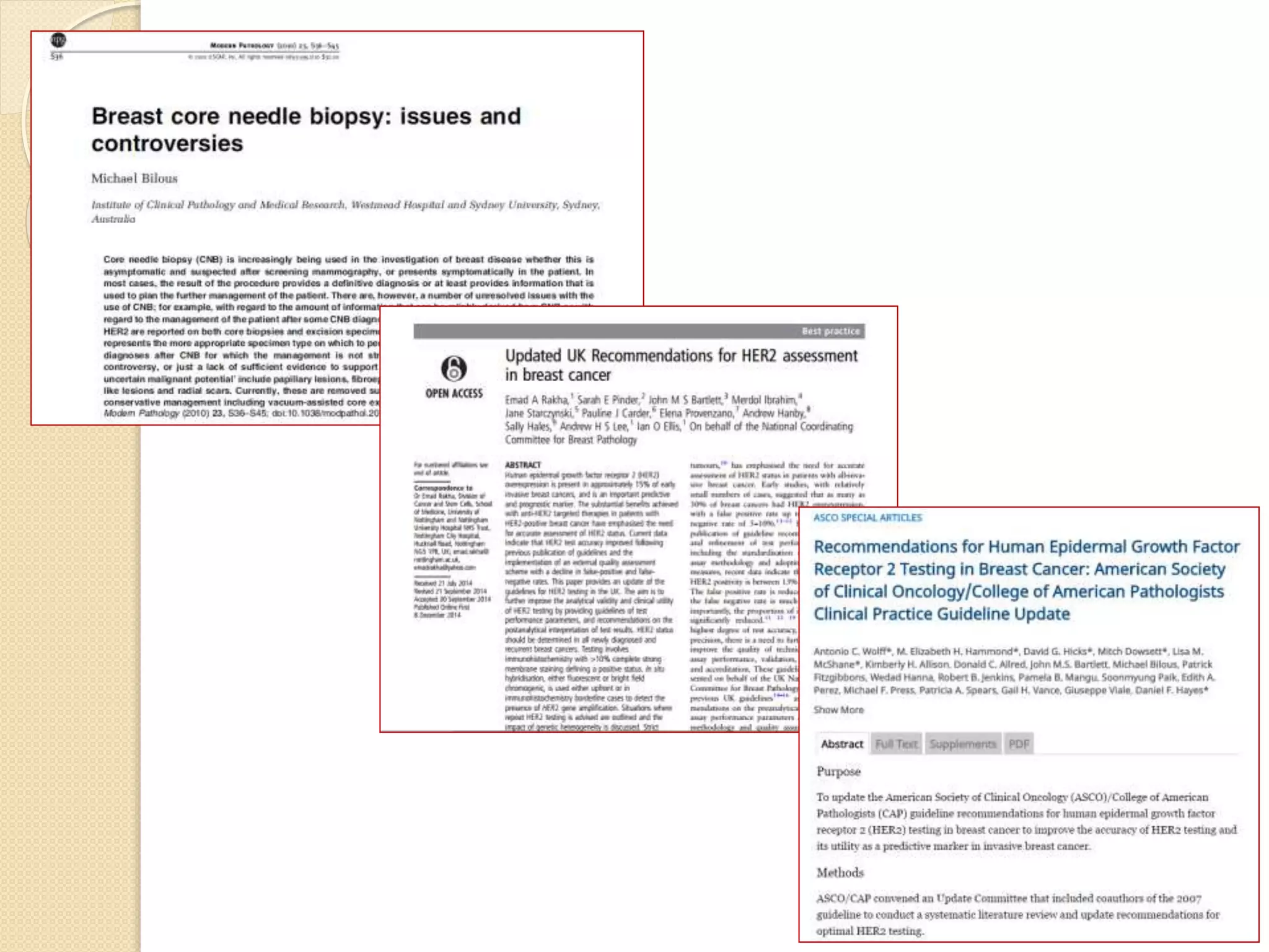 Core Needle Biopsy of Breast : Updates | PPTX