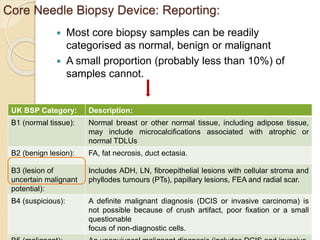 Core Needle Biopsy of Breast : Updates | PPTX | Cancer | Diseases and ...