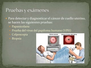 Cáncer cervicouterino | PPTX