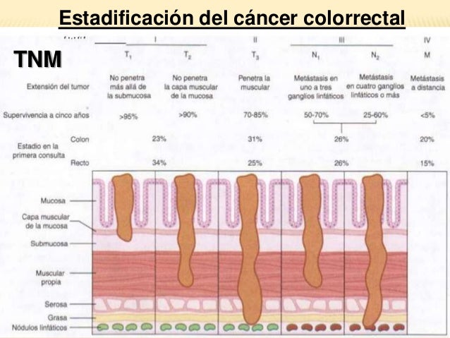 Cáncer colorectal levy