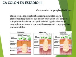 cancercolorrectal generalidades en cirugia | PPTX