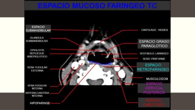Cáncer de cabeza y cuello 2