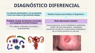 CÁNCER DE CERVIX GINECOLOGIA, PATOLOGIA COMUN | PPTX