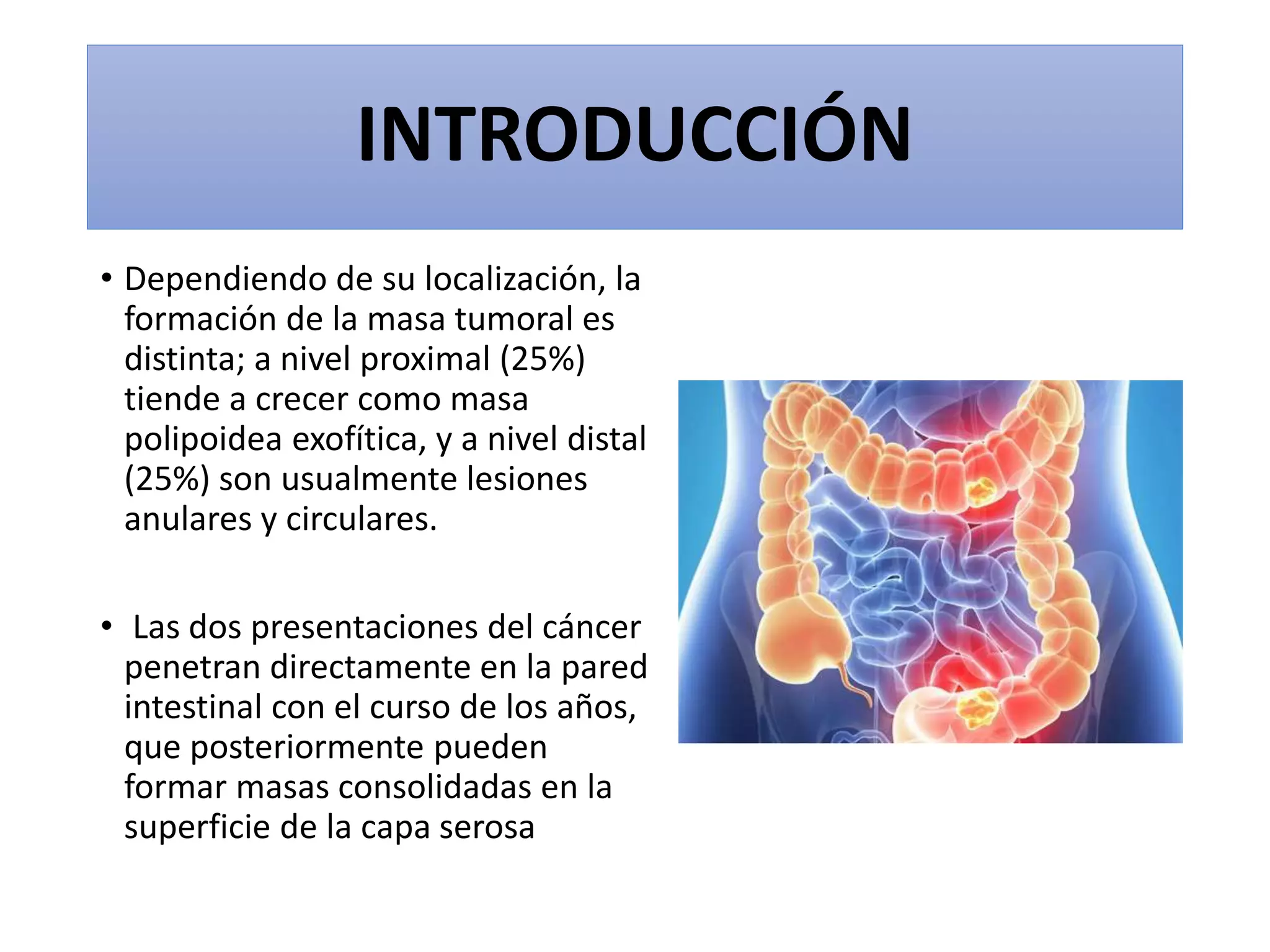 Cáncer de colon, recto y ano | PPTX