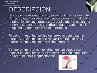 Cáncer de cérvix o cuello uterino | PPT