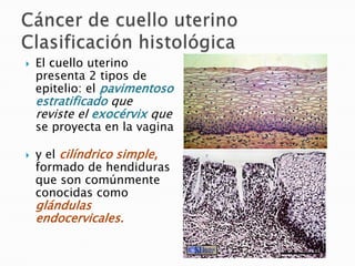 Cáncer de cuello uterino | PPTX