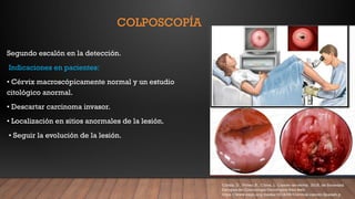Cáncer cervicouterino (epidemiología, diagnóstico y tratamiento) | PPTX