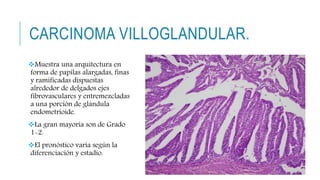 Cáncer de endometrio :) | PPTX