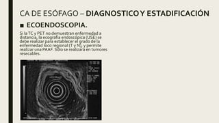 Cáncer de esófago | PPTX