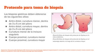 Cáncer de Estómago.pptx