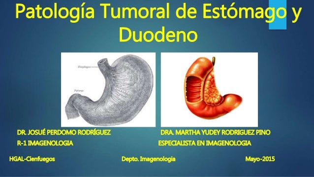 Cáncer de estómago y duodeno en Imagenología