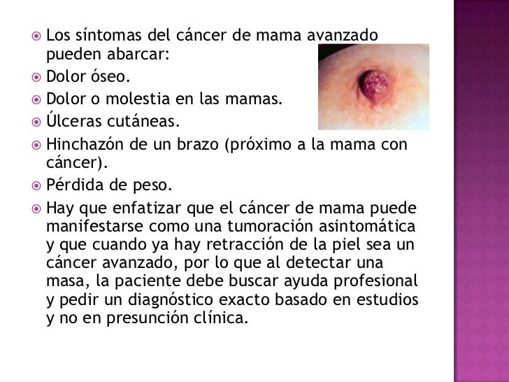 Cáncer de mama
